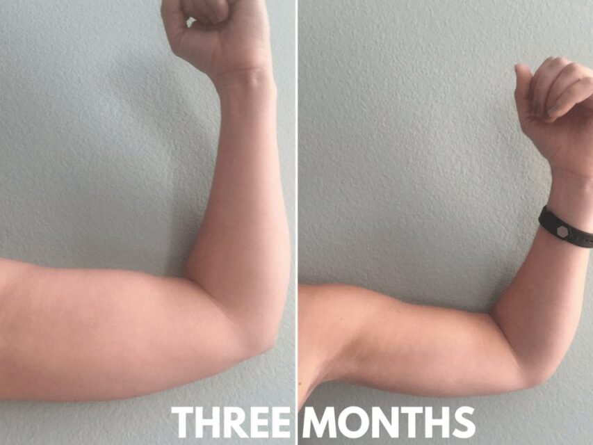Arm Flab Fighting: My Before & After Transformation Plan