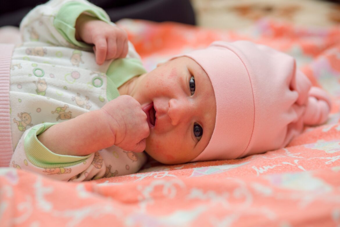 Identify Your Child's Rashes: Essential Guide for Parents